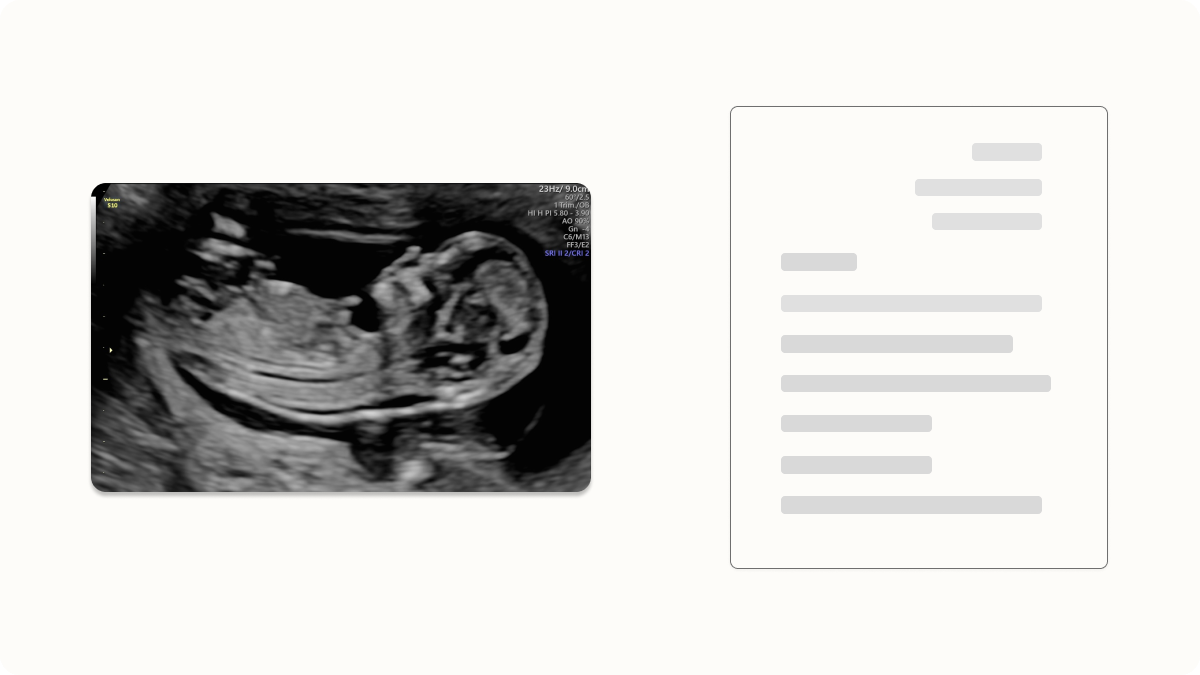 NT Scan Results Explained – What Your 12-Week Scan Shows